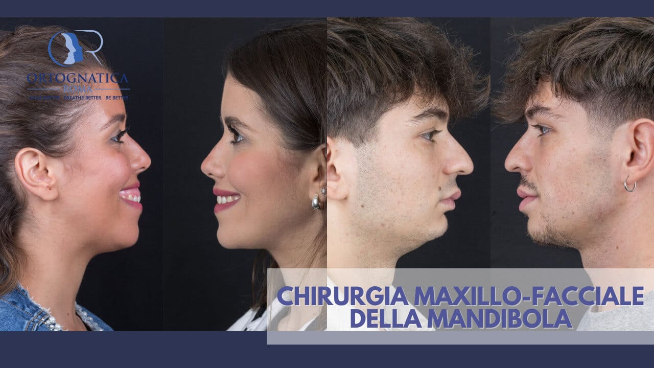 Chirurgia Maxillo-Facciale della Mandibola - OrtognaticaRoma