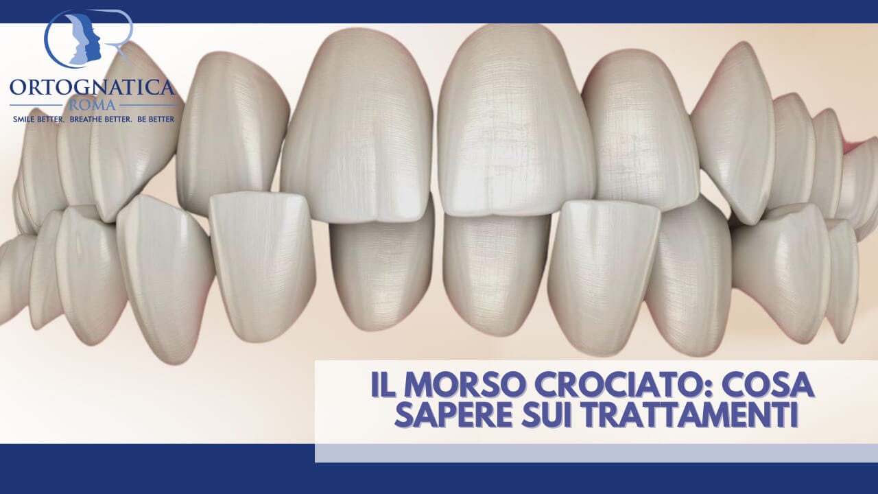 Il Morso Crociato: cosa sapere sui trattamenti - OrtognaticaRoma